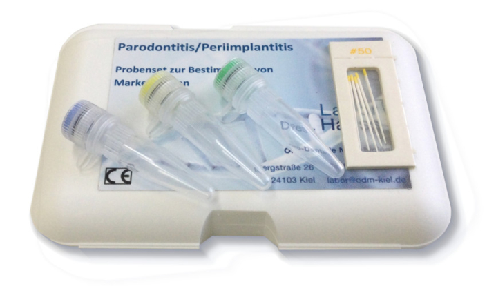 Mikrobiologischer-Parodontitis-Test: Untersuchung zur Bestimmung der ...