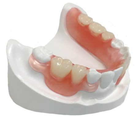 Valplast-die Prothese für Allergiker - myzahnarzt.com