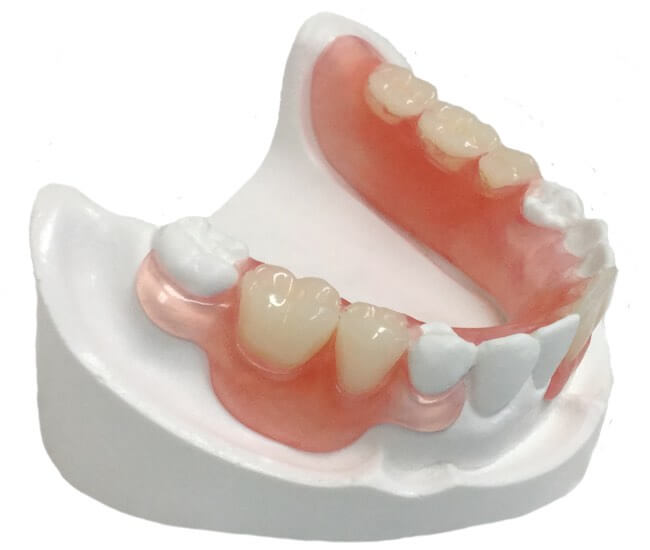 Valplast-die Prothese für Allergiker - myzahnarzt.com